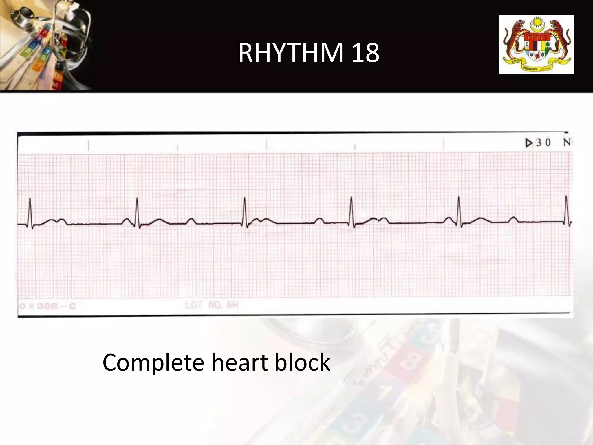 Rhythm recognition | PPTX