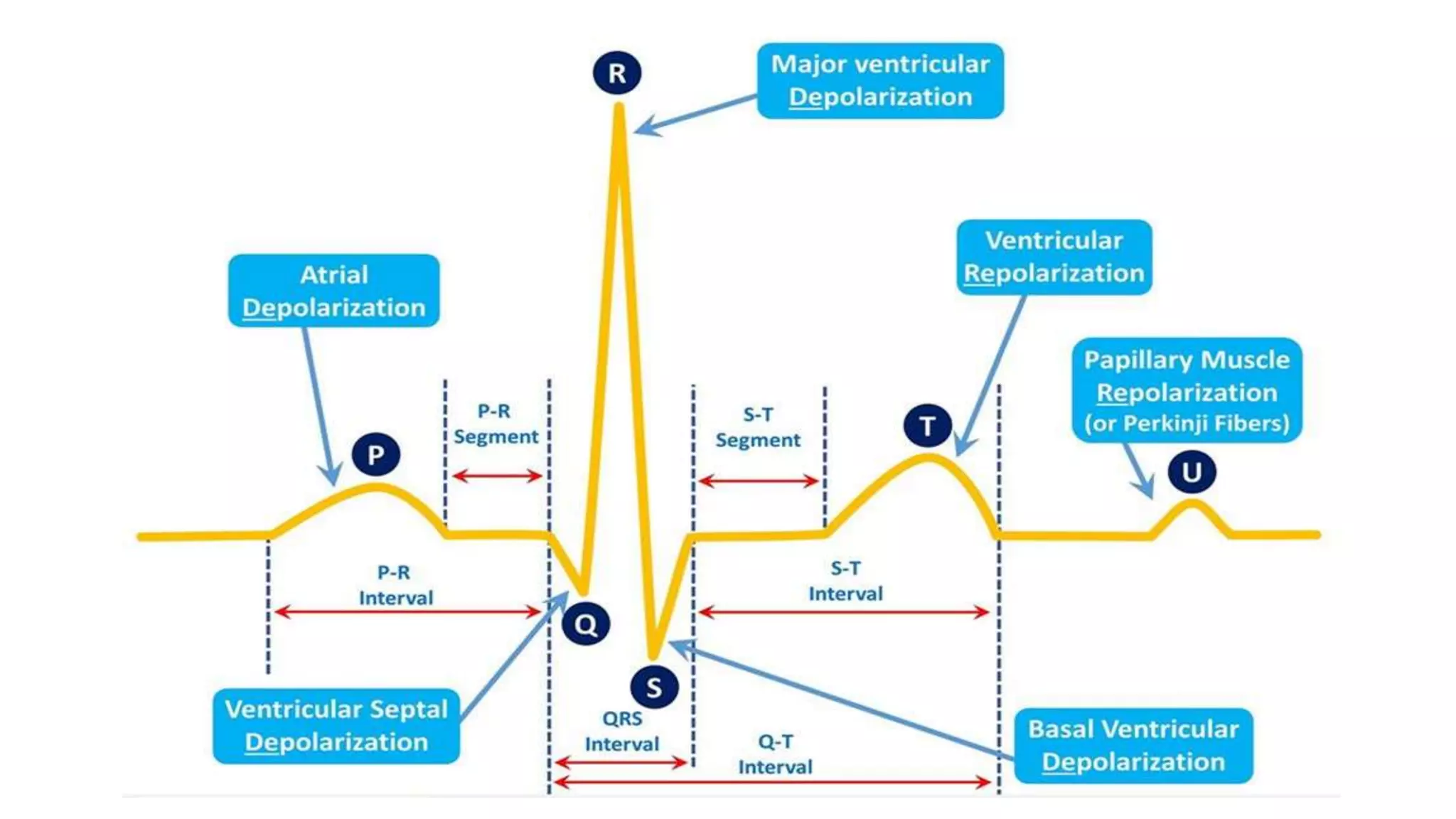 basic ECG rhythms & rhythms on different conditions | PPTX | Heart and ...