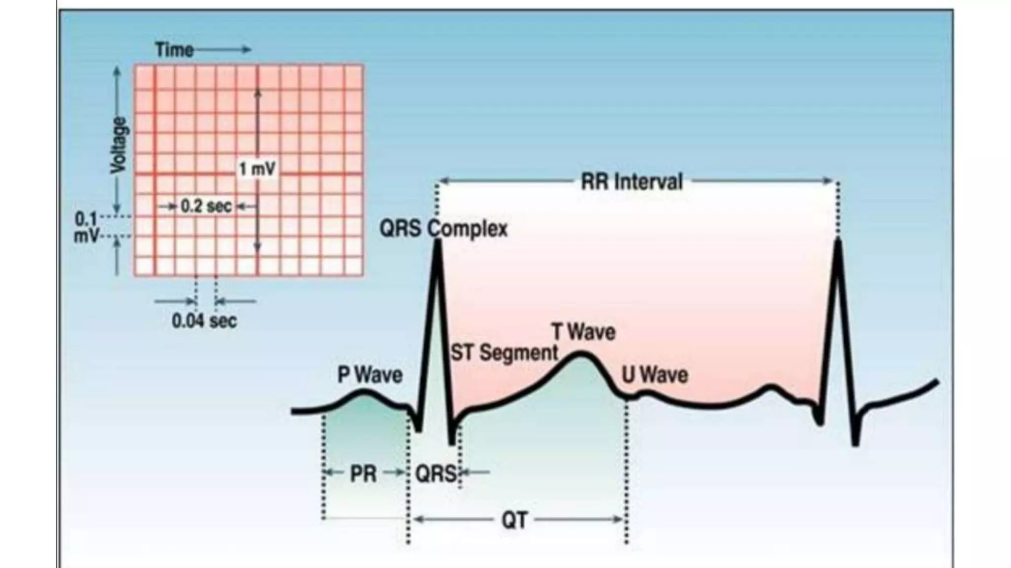 basic ECG rhythms & rhythms on different conditions | PPTX