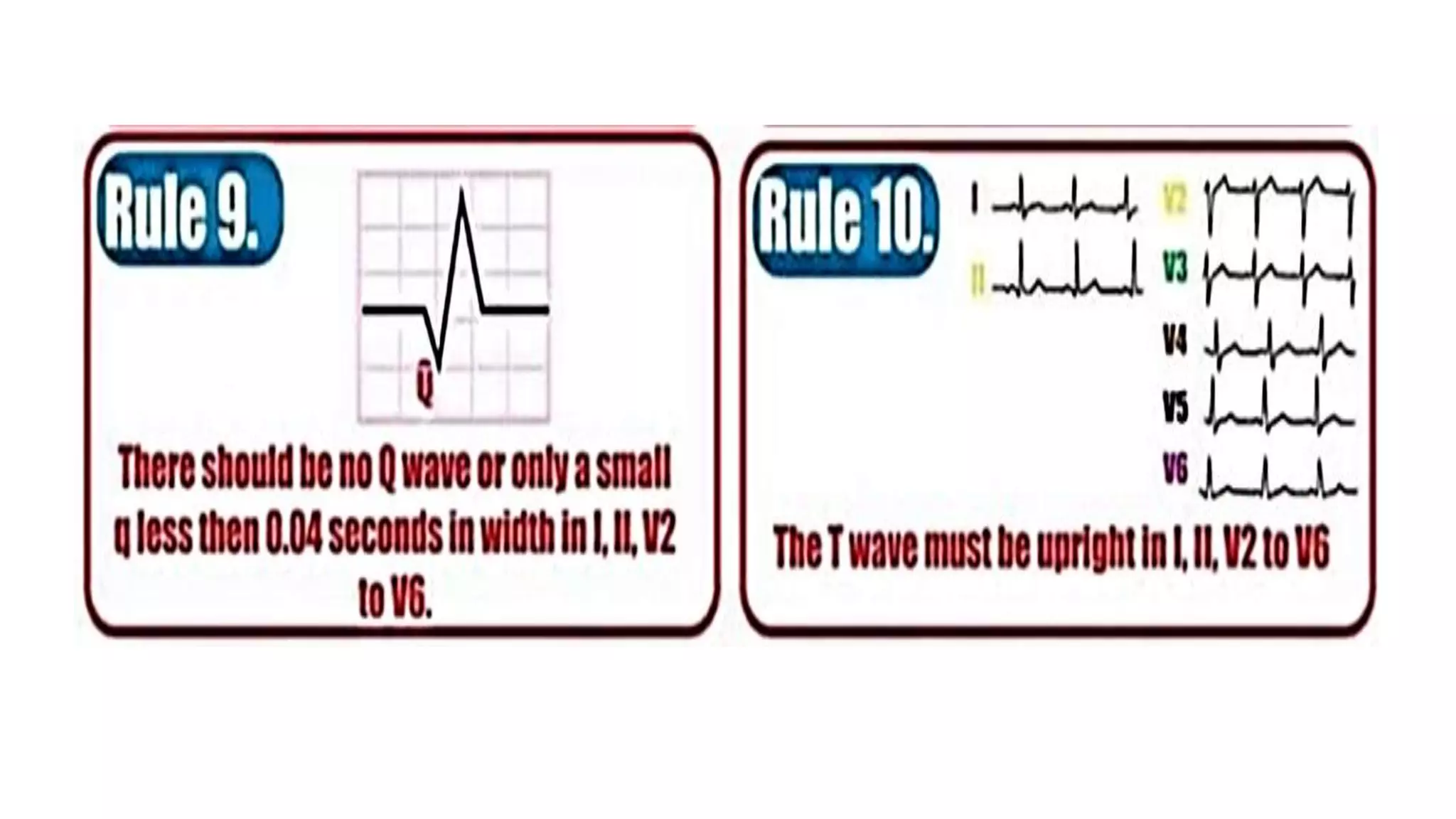 basic ECG rhythms & rhythms on different conditions | PPTX