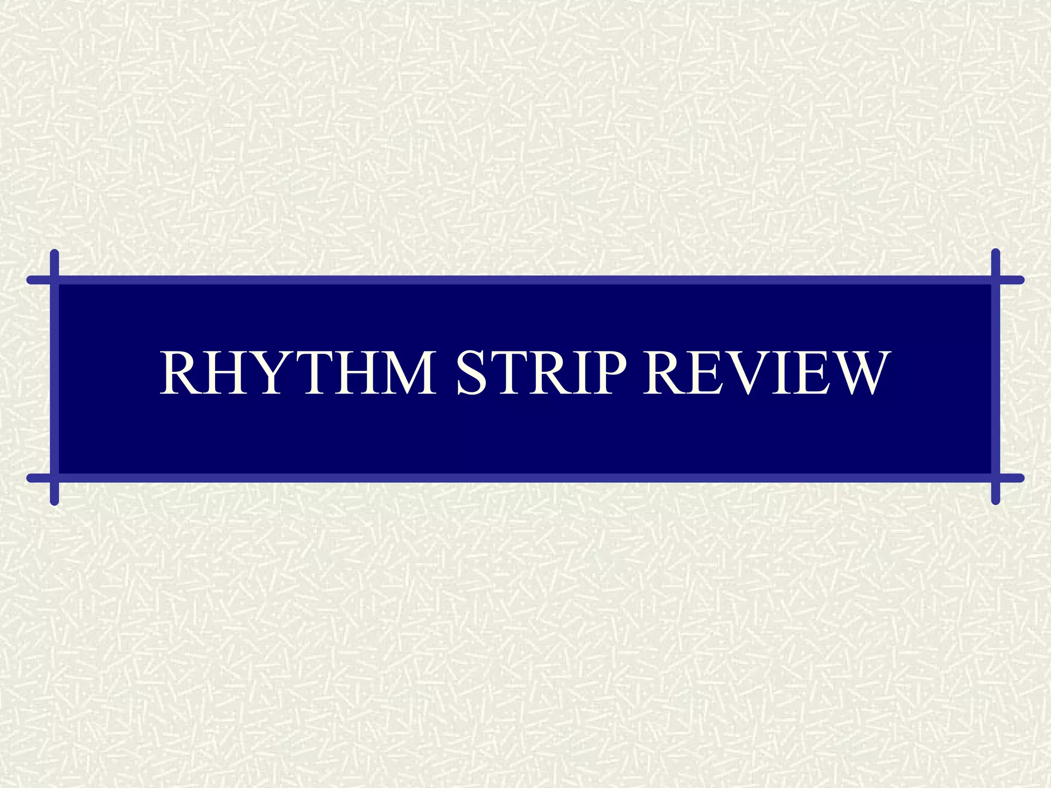 Rhythm Strip Review | PPT