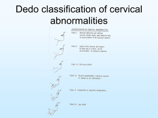Rhytidectomy (Face Lift) | PPT