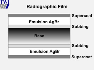 Radiographic Interpretation Limited Radiographicc | PPT