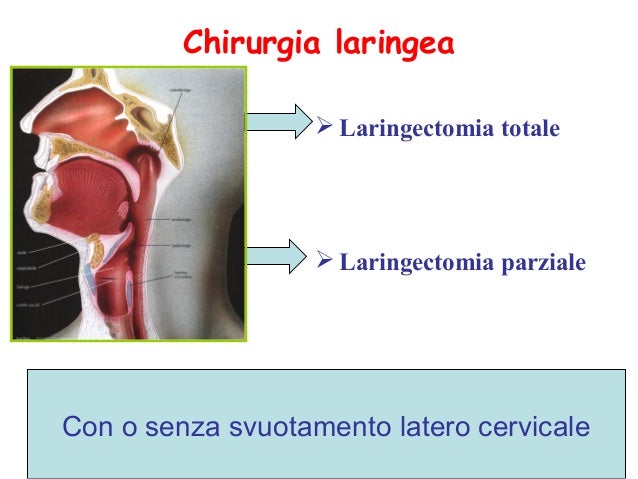 La riabilitazione nella chirurgia laringea