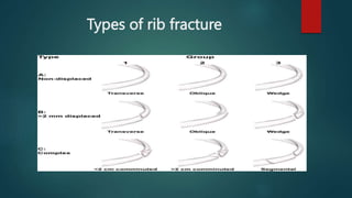 Rib Fractures, Flail Chest & Stove In Chest | PPTX