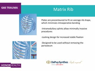 Rib Fractures in the Elderly (Dr. Francis Ali-Osman) | PDF