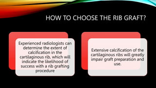 rib graft for rhinoplasty for revision rhinoplasty | PPT