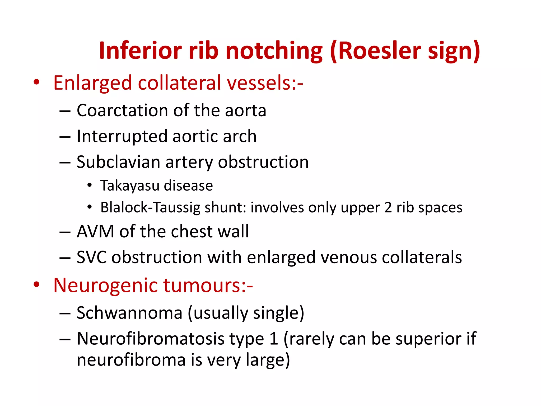 Rib notching | PPTX