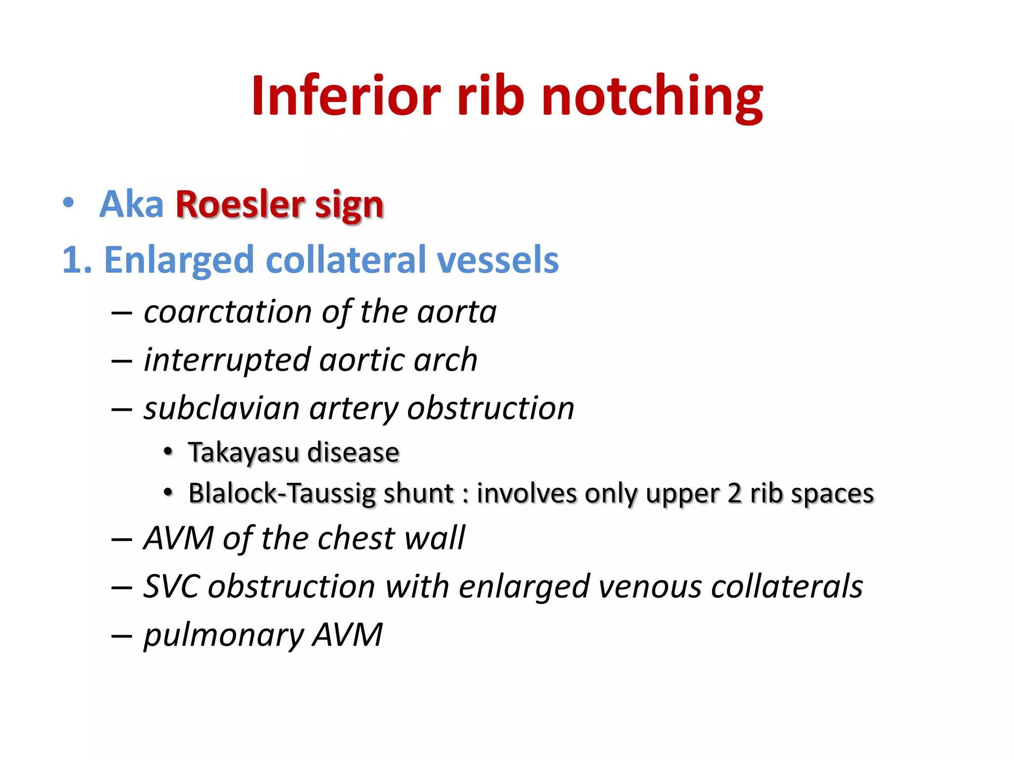 Rib notching | PPTX