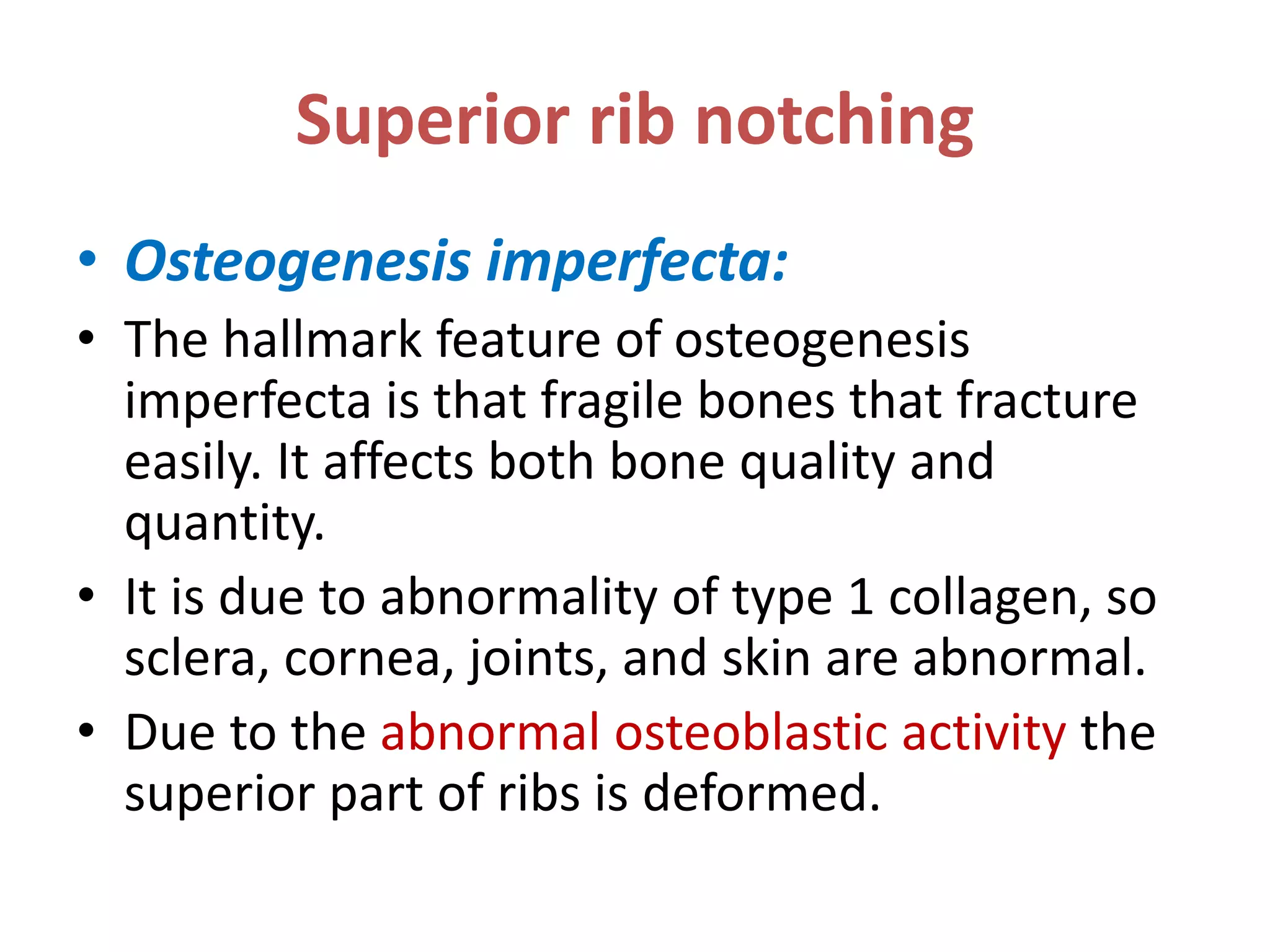 Rib notching | PPTX