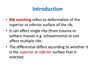 Rib notching | PPTX