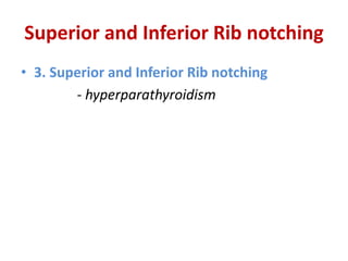 Rib notching | PPTX