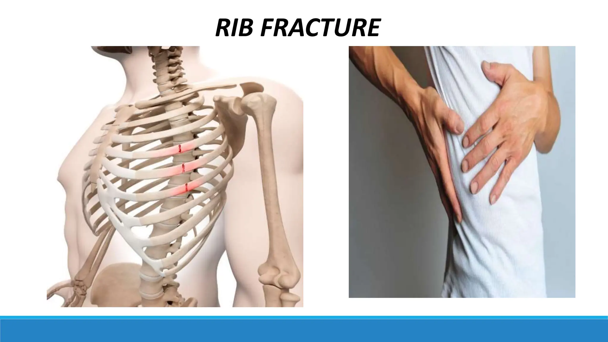 Anatomy of RIBS and the thoracic cage with function | PPTX