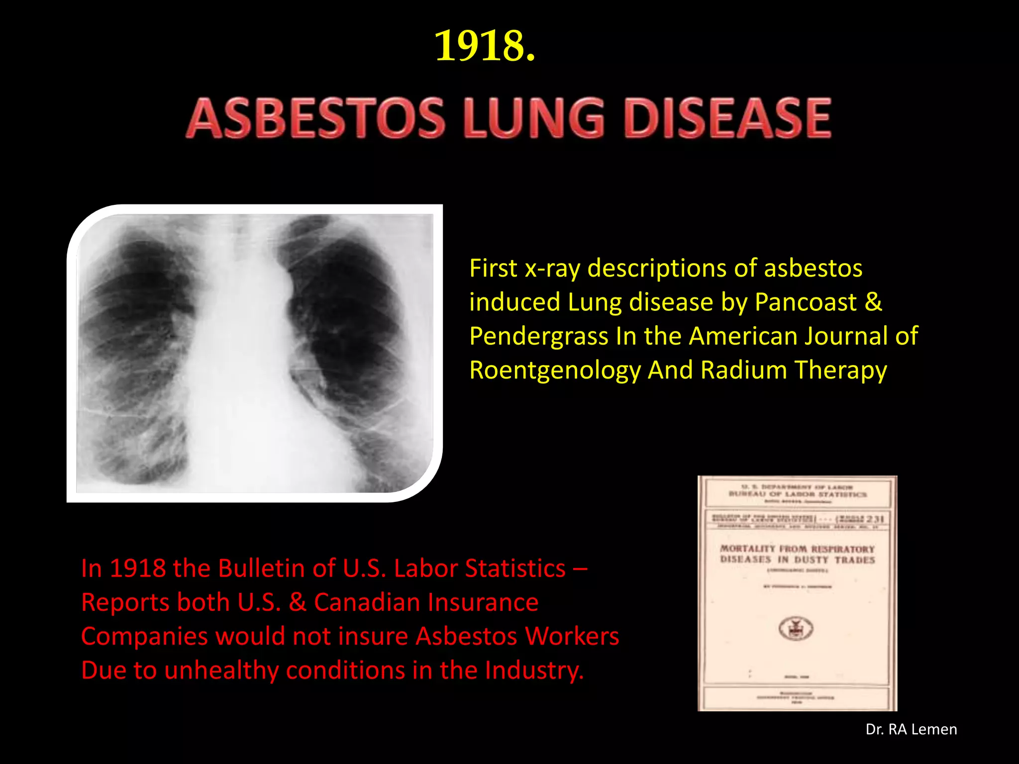 Dr. Richard Lemen: What you should know about asbestos | PPTX | Lung and Respiratory Health ...