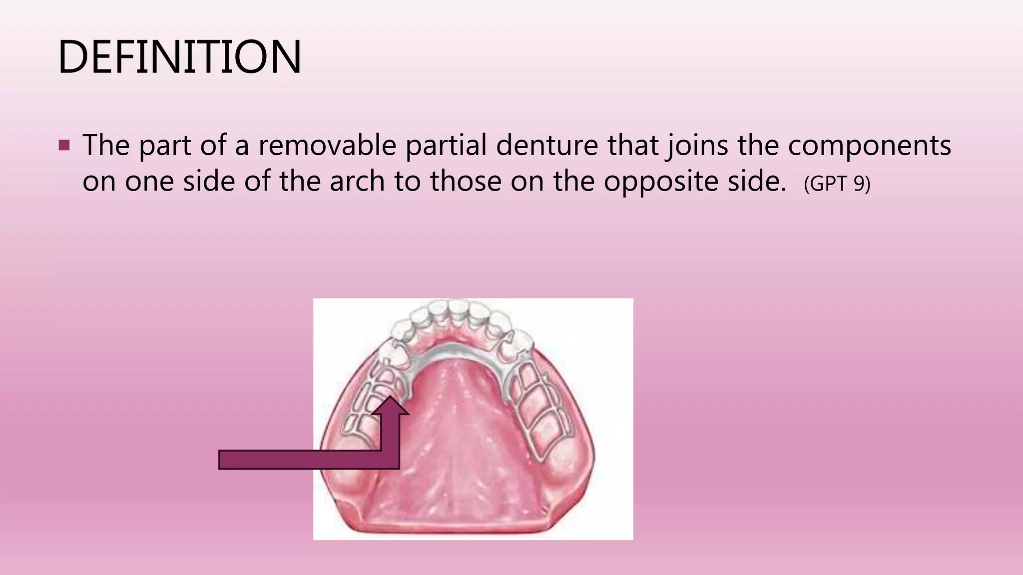 MANDIBULAR MAJOR CONNECTORS | PPTX