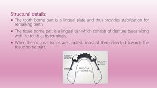 MANDIBULAR MAJOR CONNECTORS | PPTX