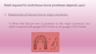 MANDIBULAR MAJOR CONNECTORS | PPTX