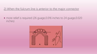 MANDIBULAR MAJOR CONNECTORS | PPTX