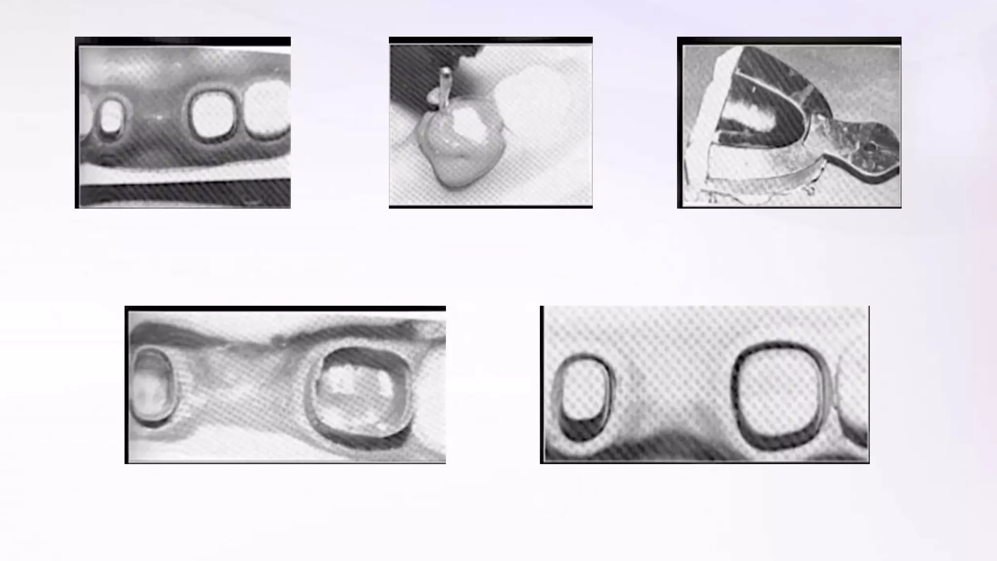 Impression Techniques in Fixed partial denture | PPTX