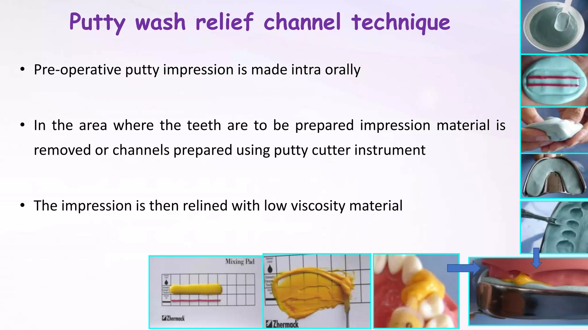 Impression Techniques in Fixed partial denture | PPTX