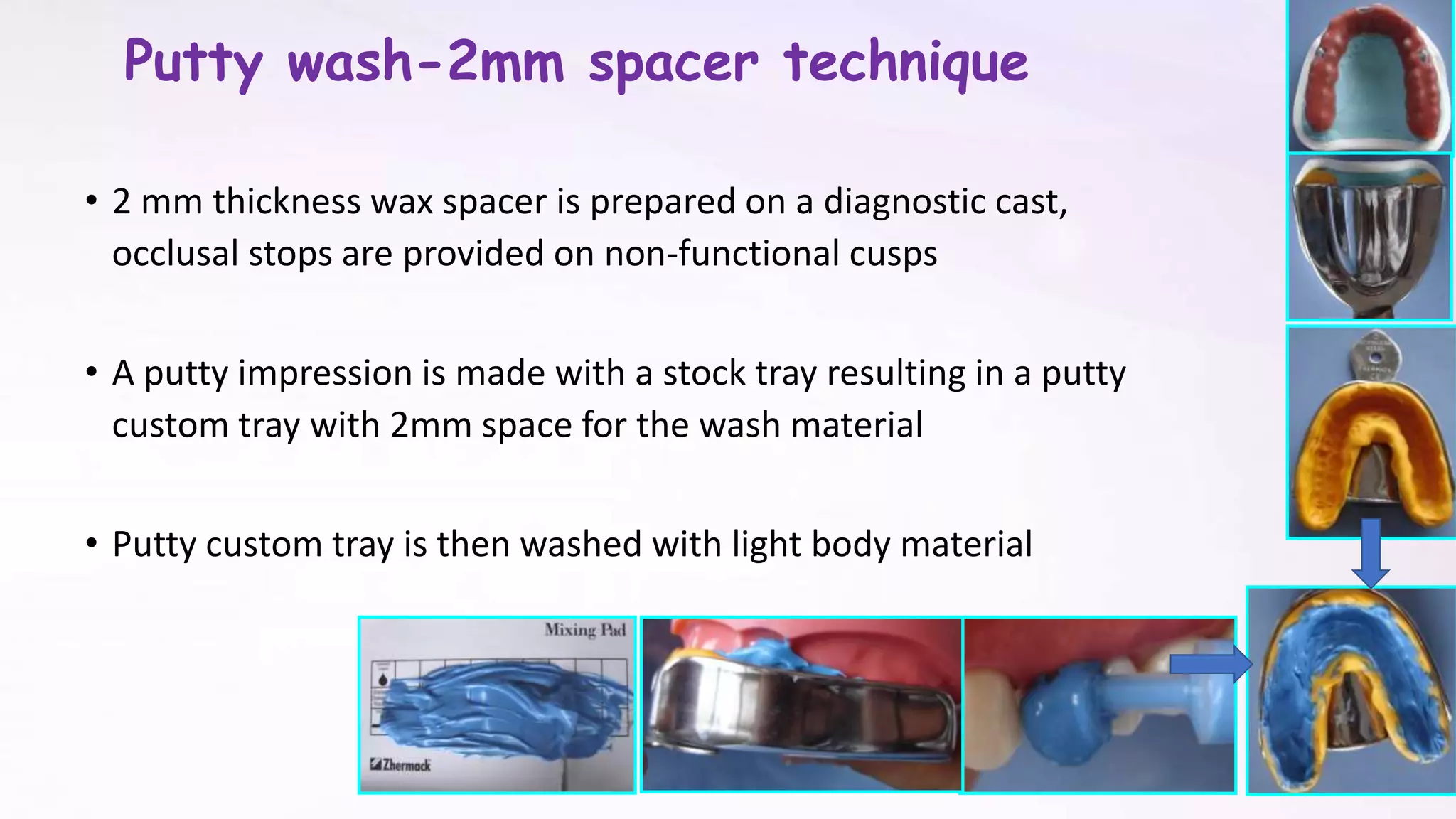 Impression Techniques in Fixed partial denture | PPTX