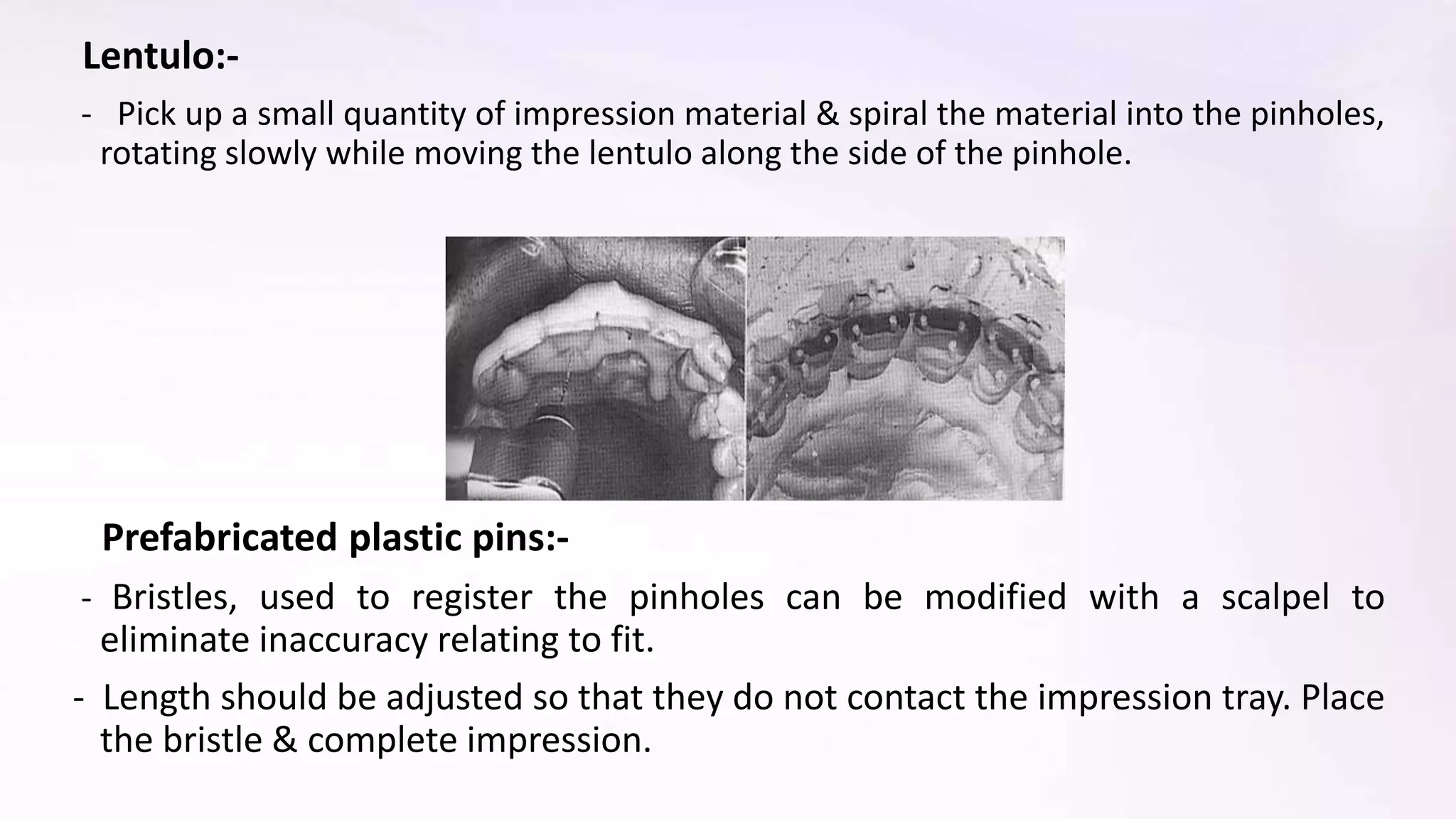 Impression Techniques in Fixed partial denture | PPTX