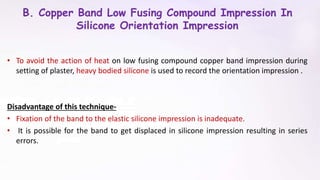 Impression Techniques in Fixed partial denture | PPTX