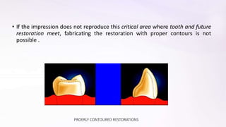 Impression Techniques in Fixed partial denture | PPTX