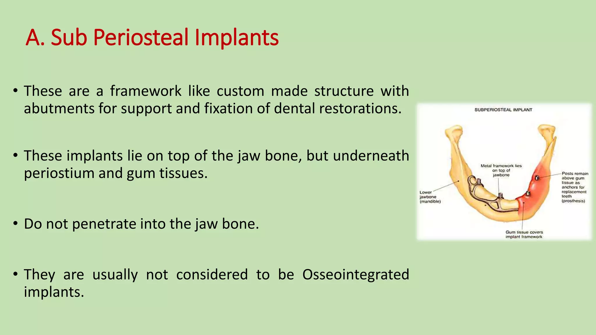 Dental Implant Designs | PPTX