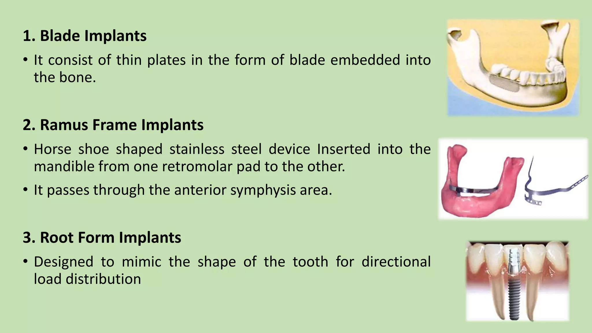 Dental Implant Designs | PPTX