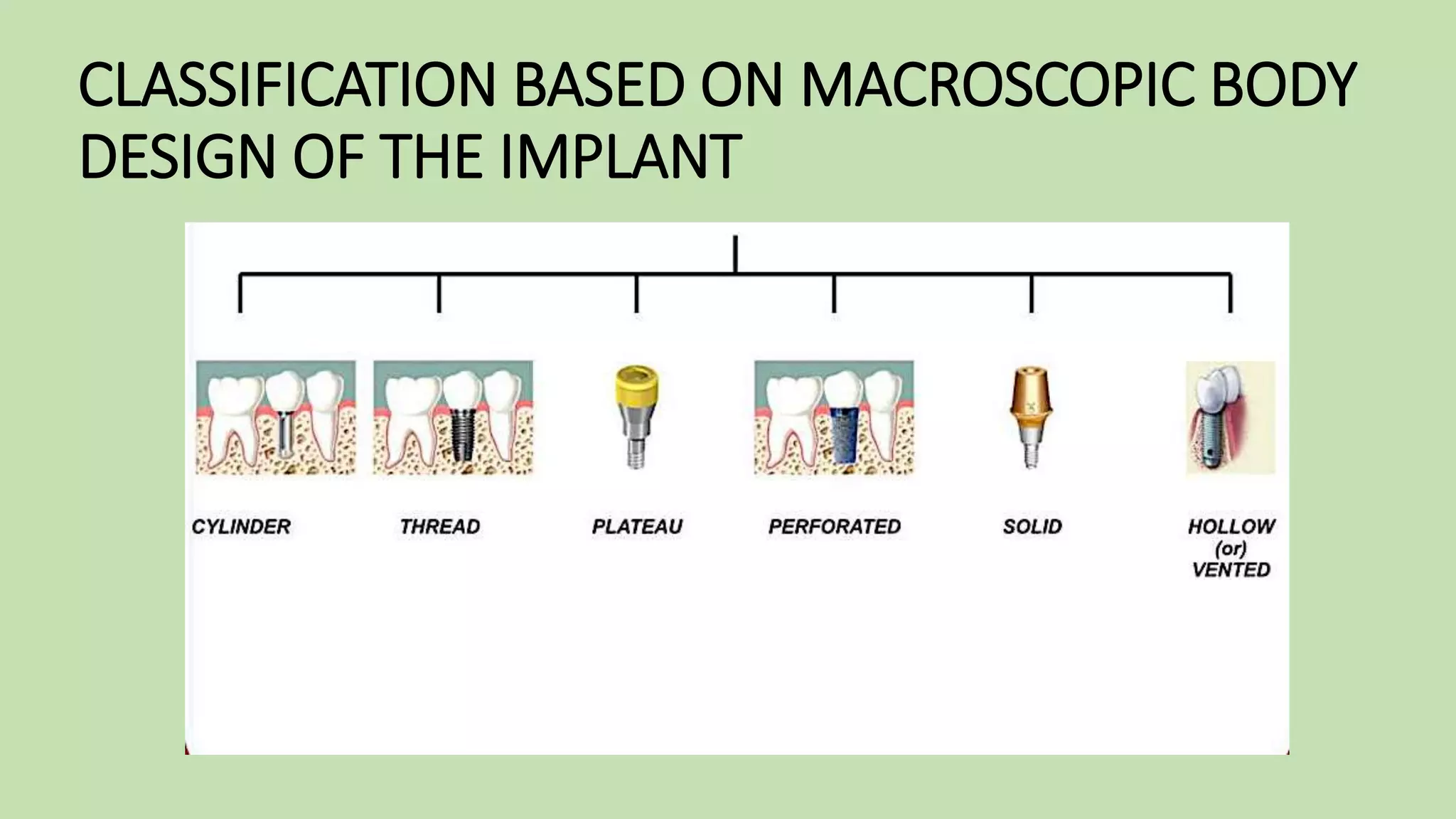 Dental Implant Designs | PPTX