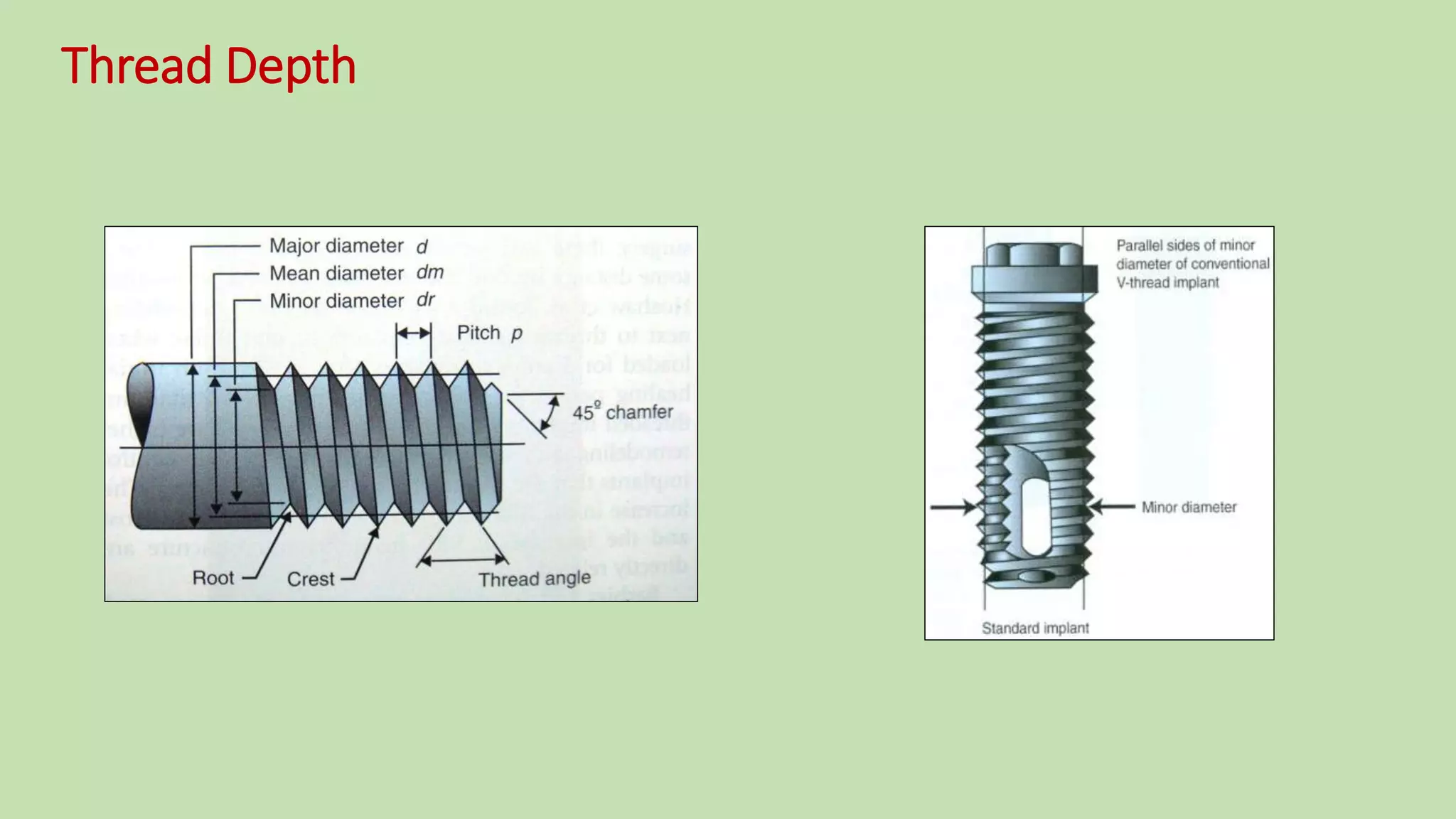 Dental Implant Designs | PPTX