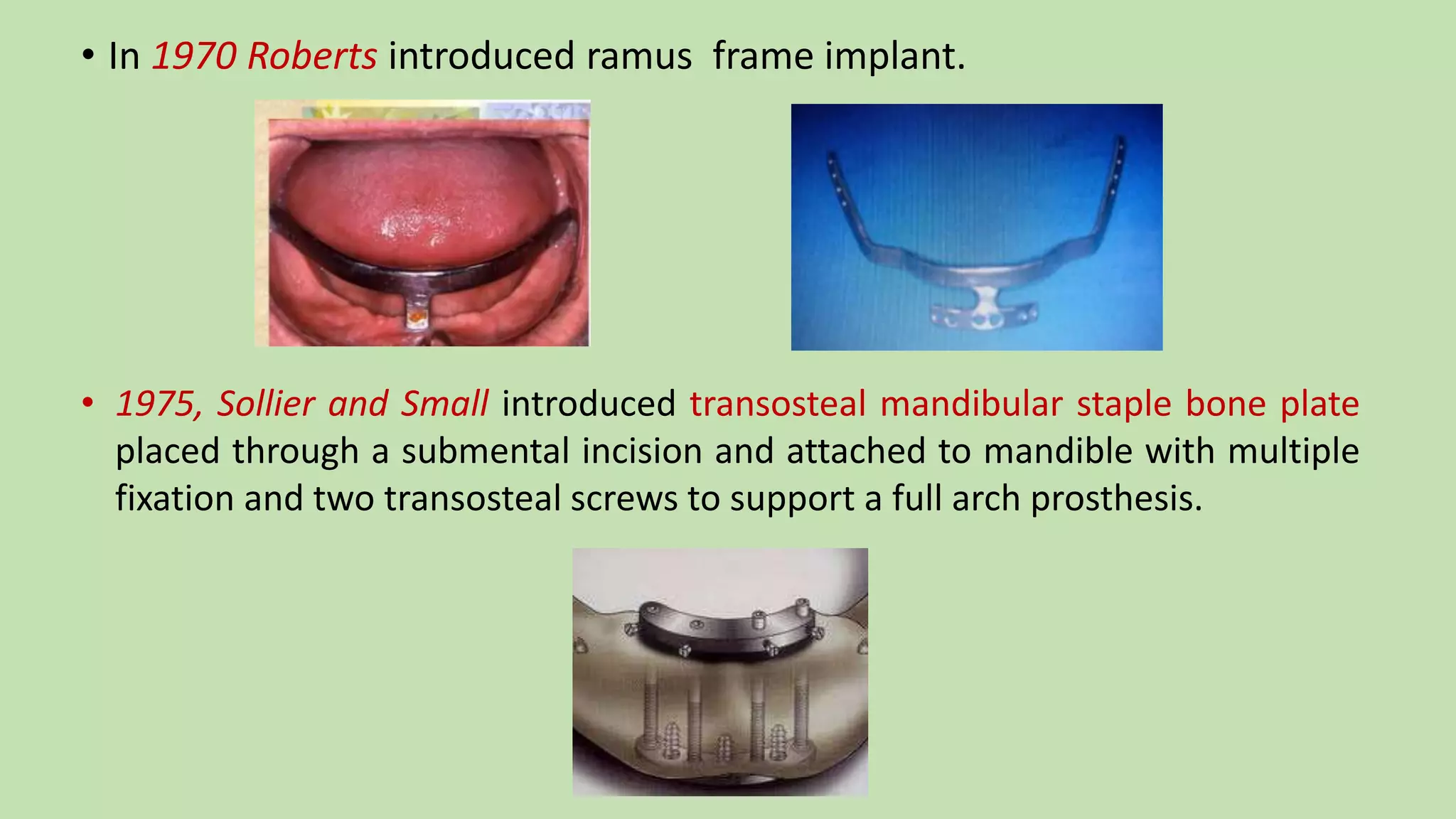 Dental Implant Designs | PPTX
