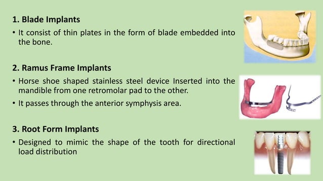 Dental Implant Designs | PPTX | Dental Health | Diseases and Conditions