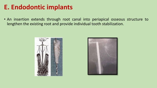 Dental Implant Designs | PPTX | Dental Health | Diseases and Conditions
