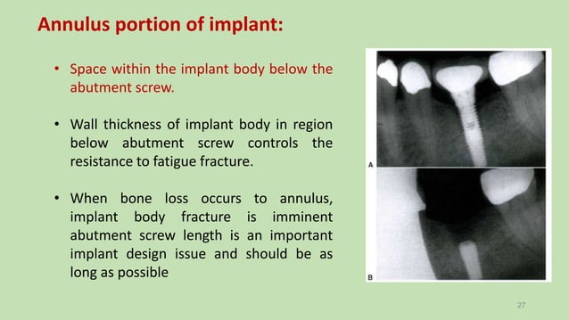 Dental Implant Designs | PPTX | Dental Health | Diseases and Conditions