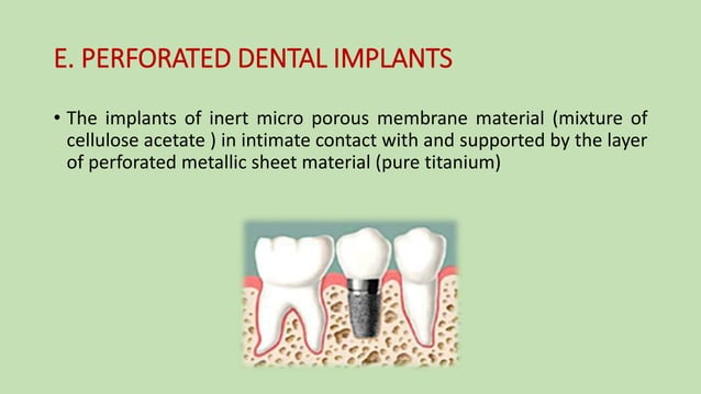 Dental Implant Designs | PPTX | Dental Health | Diseases and Conditions