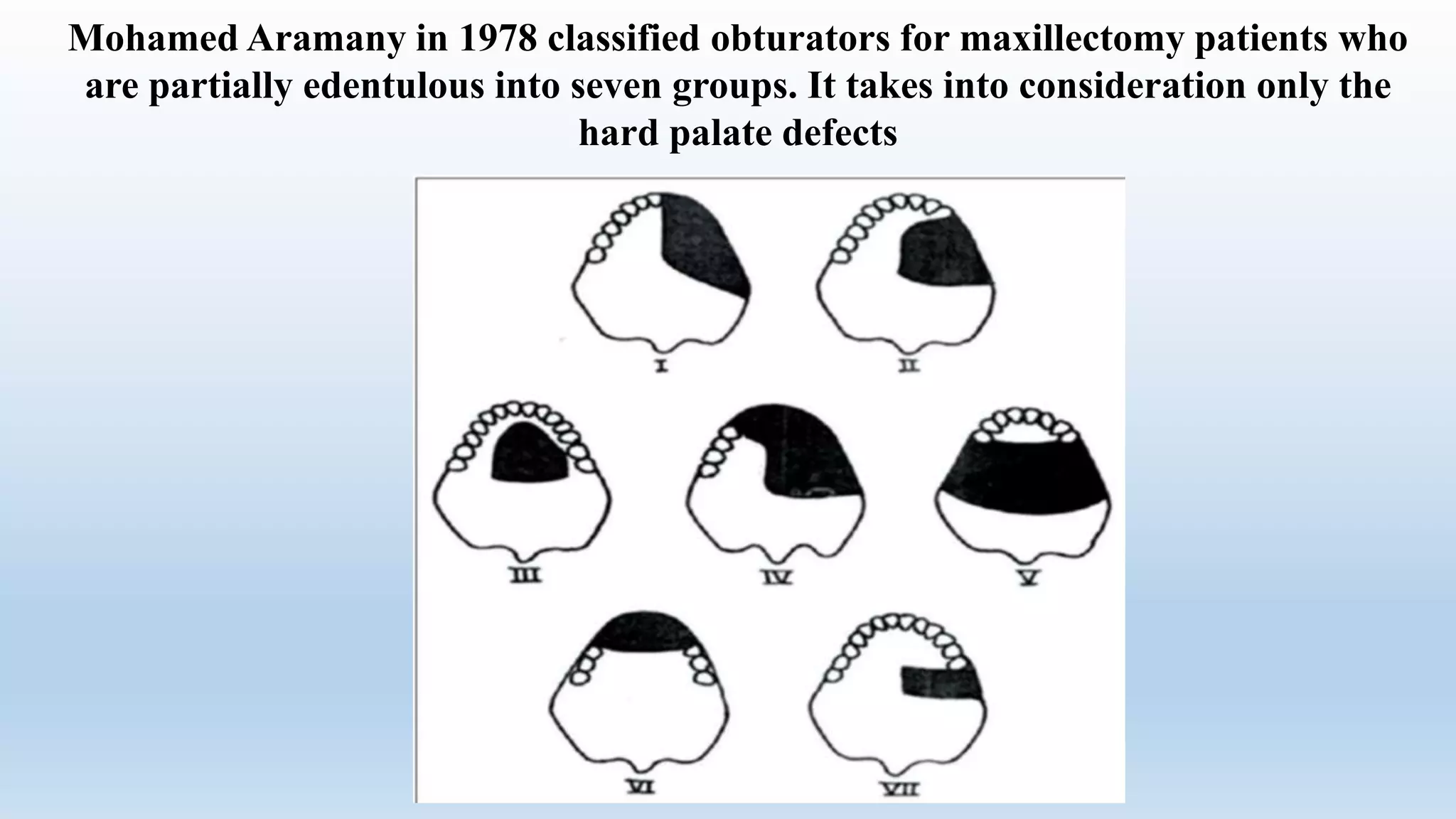 OBTURATORS FOR ACQUIRED MAXILLARY DEFECTS | PPTX