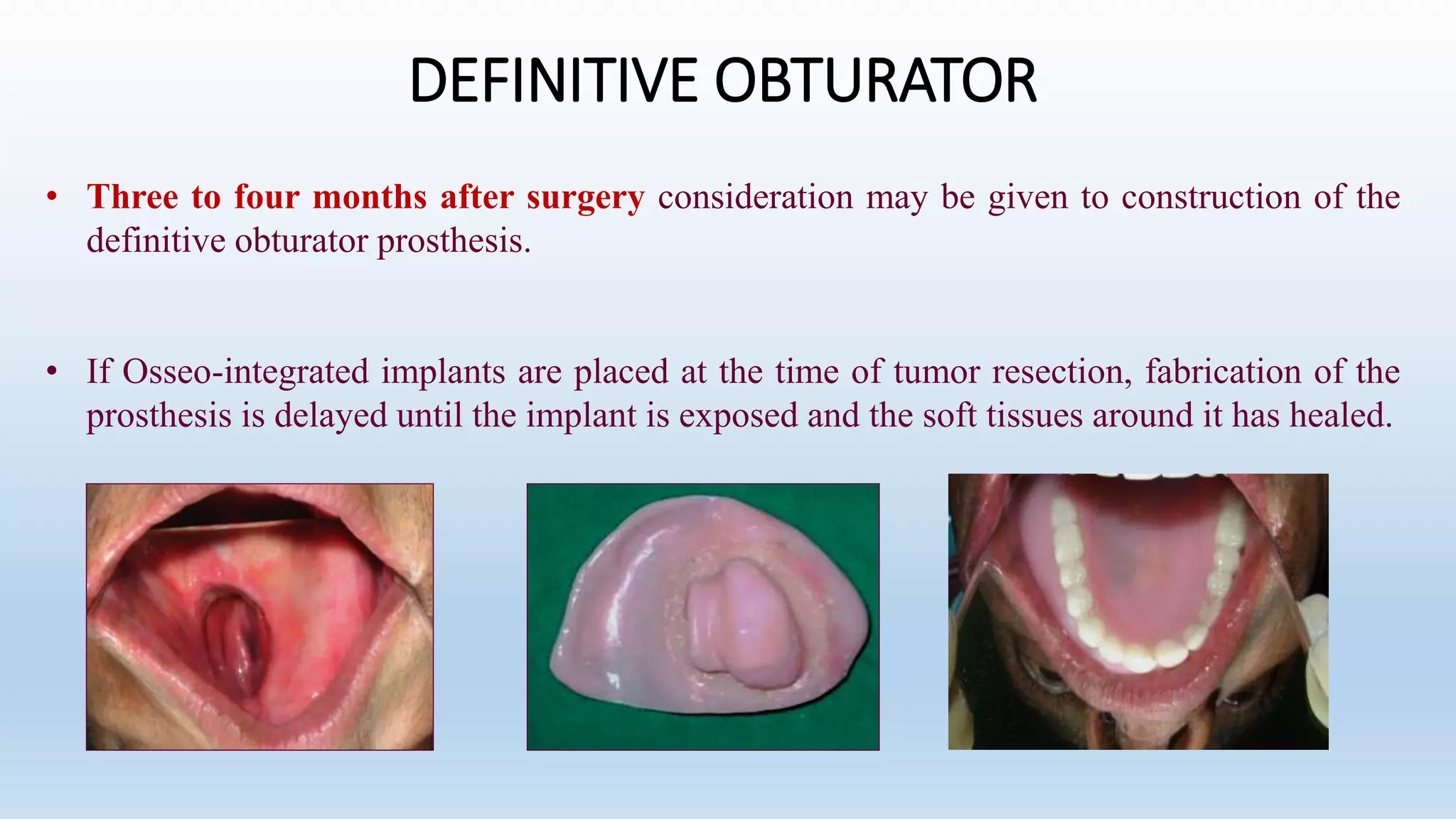 OBTURATORS FOR ACQUIRED MAXILLARY DEFECTS | PPTX
