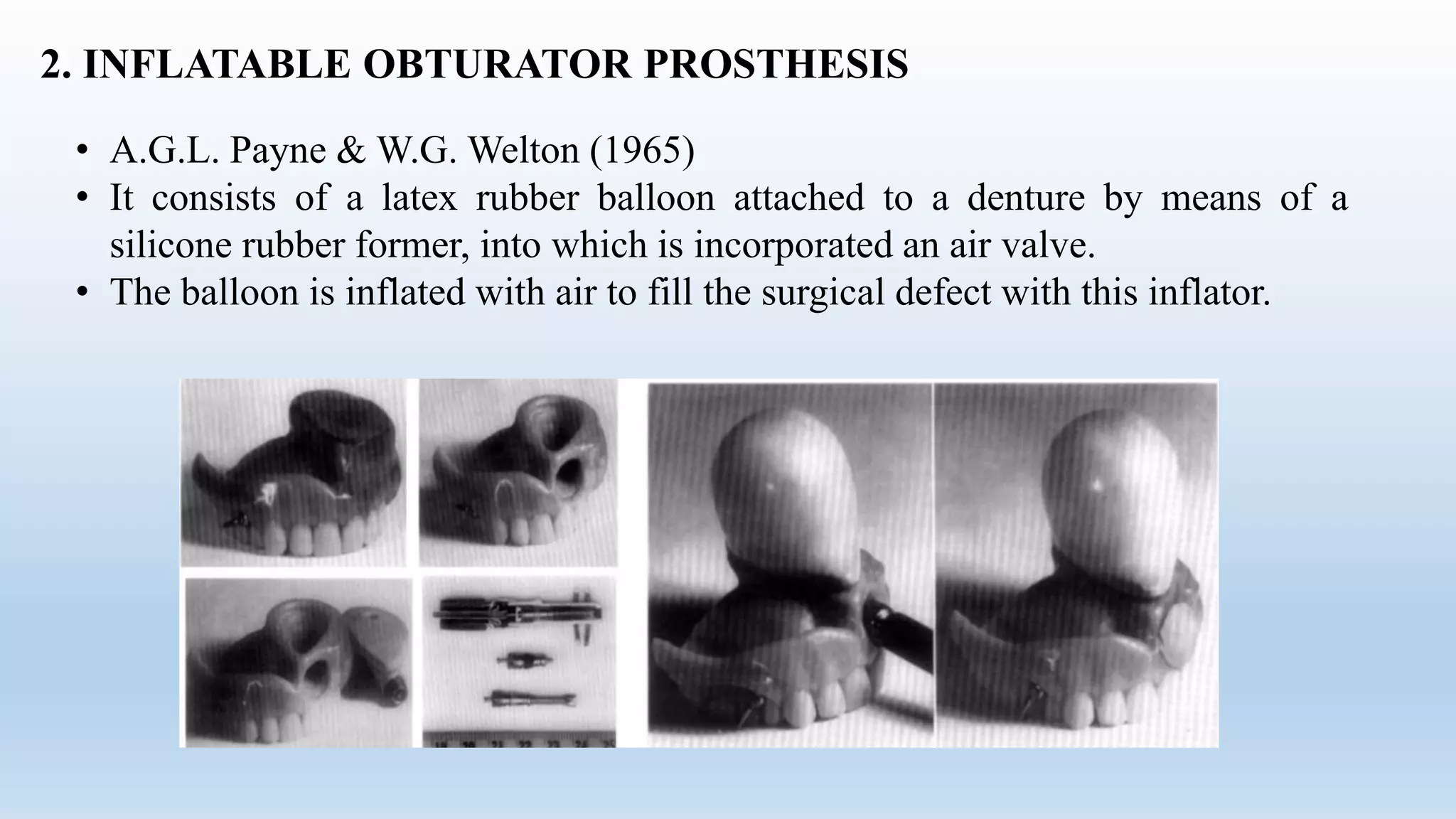 OBTURATORS FOR ACQUIRED MAXILLARY DEFECTS | PPTX