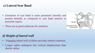 OBTURATORS FOR ACQUIRED MAXILLARY DEFECTS | PPTX