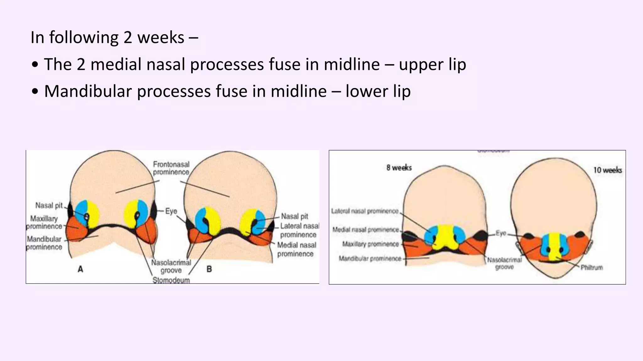 CLEFT LIP AND PALATE | PPTX