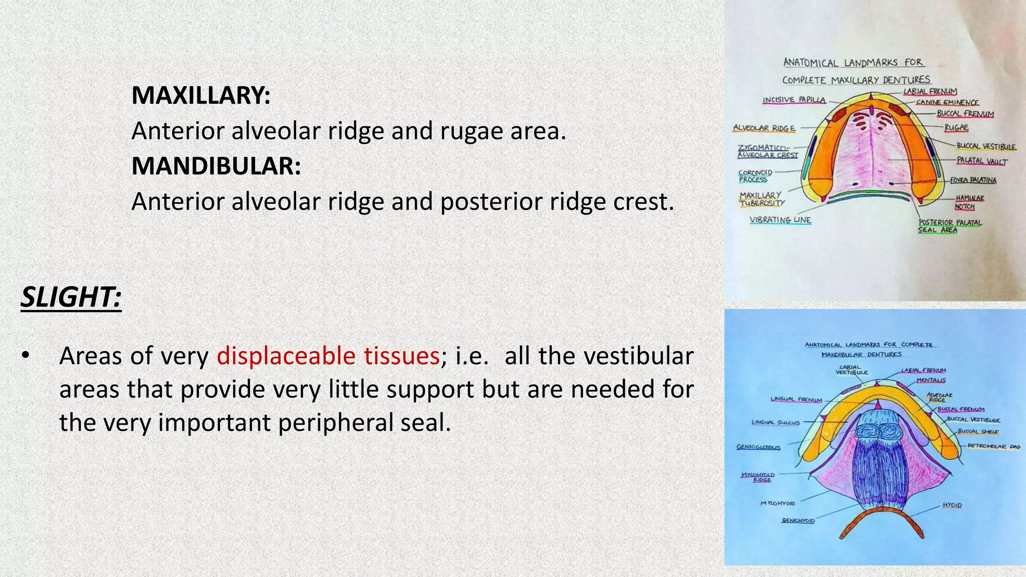 Impressions in complete denture | PPTX