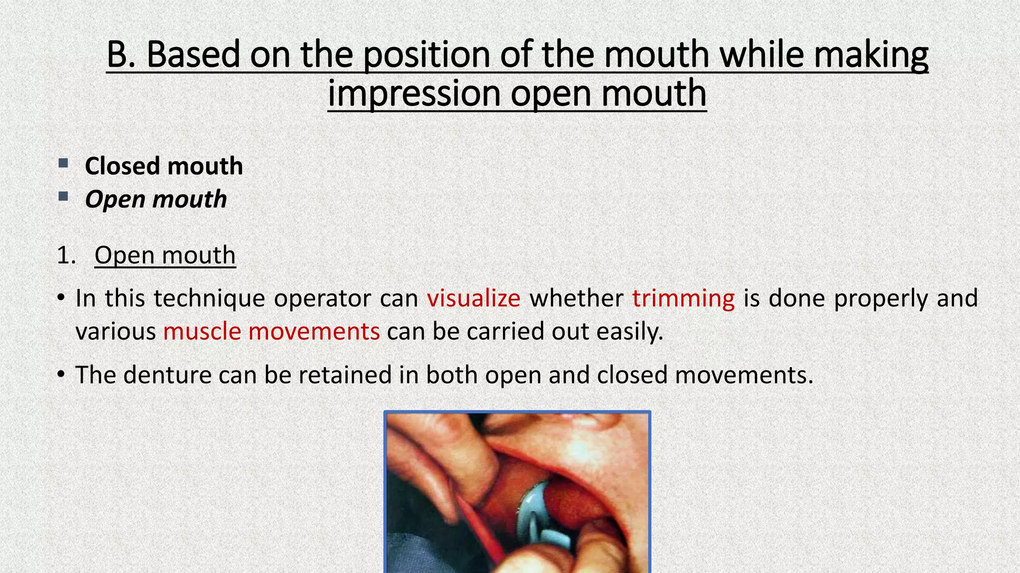 Impressions in complete denture | PPTX