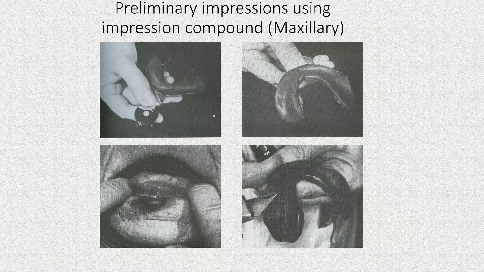 Impressions in complete denture | PPTX