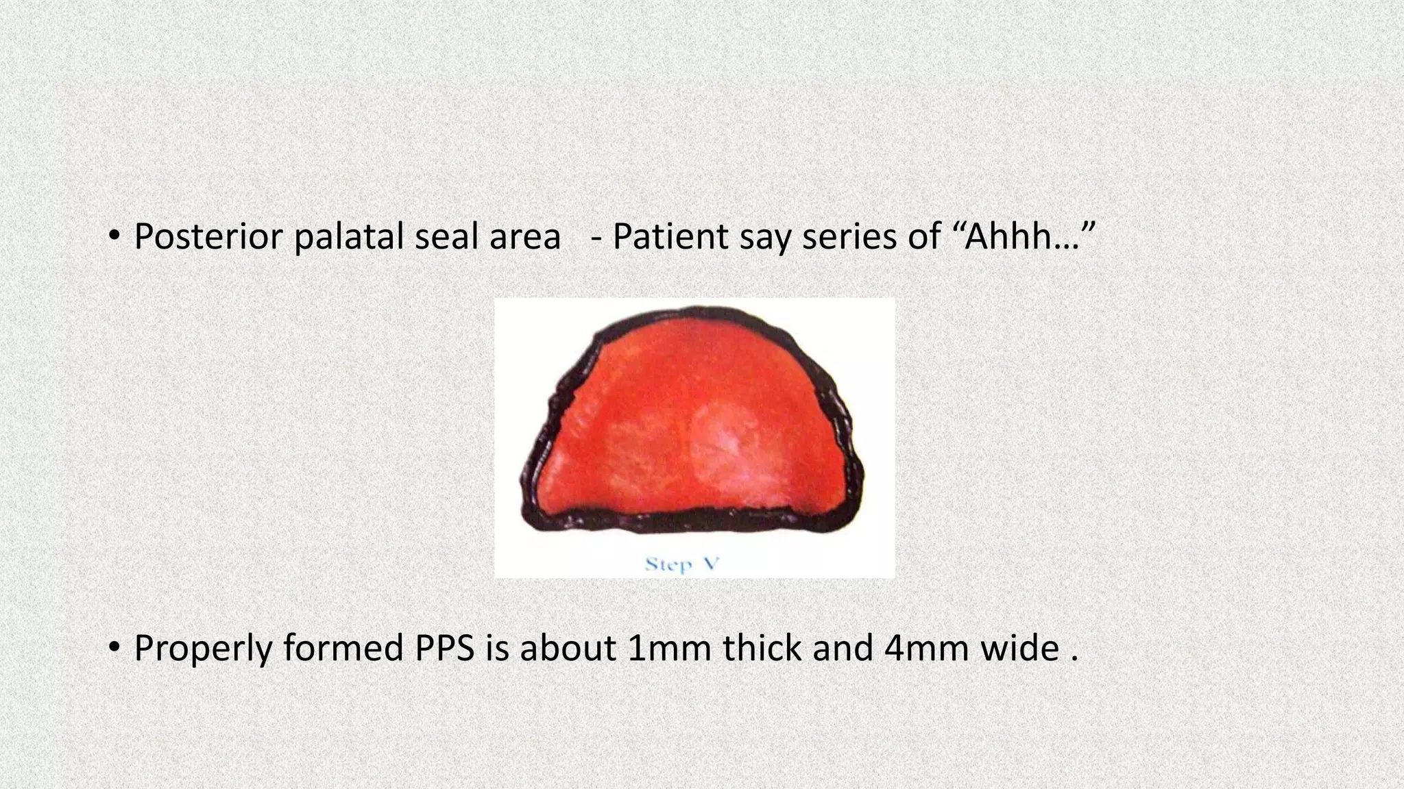 Impressions in complete denture | PPTX