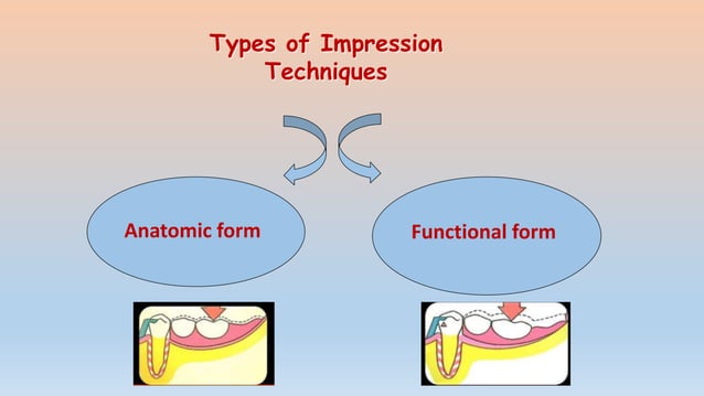 impression techniques in Removable Partial Denture | PPTX | Oral care ...