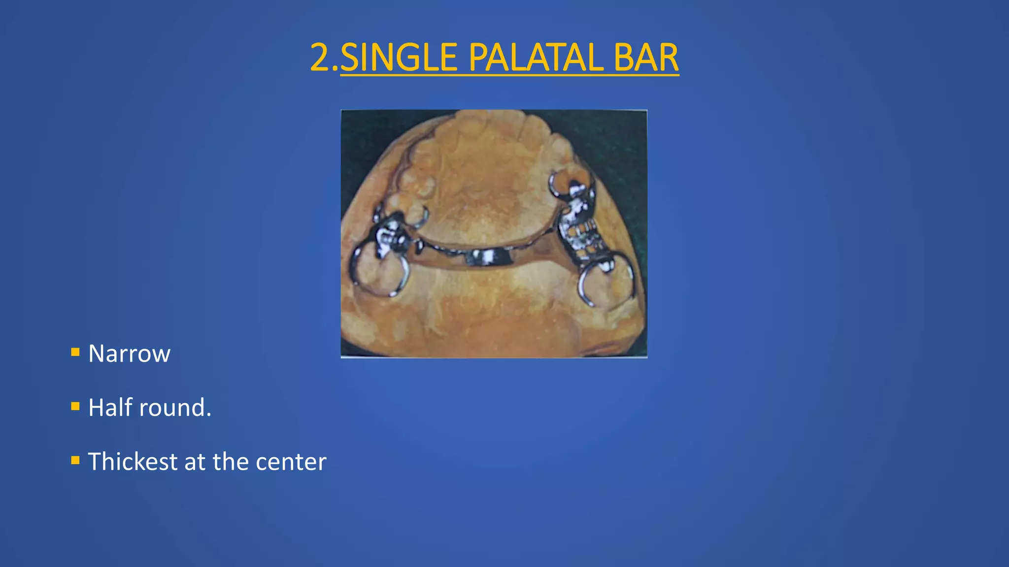 MAXILLARY MAJOR CONNECTORS | PPT
