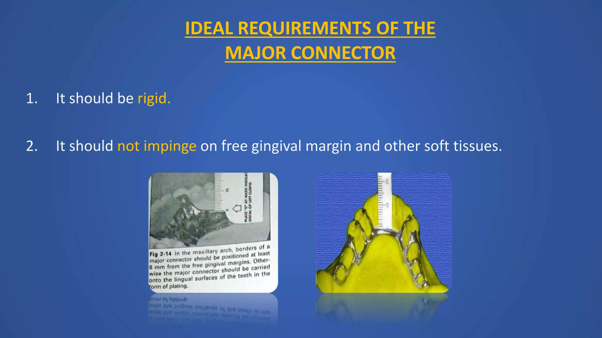 MAXILLARY MAJOR CONNECTORS | PPT