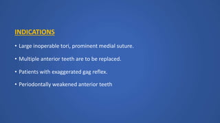 MAXILLARY MAJOR CONNECTORS | PPT